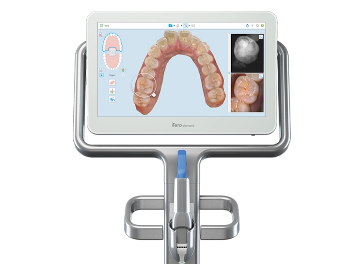 Itero Element™ 5d Imaging Smile Matters